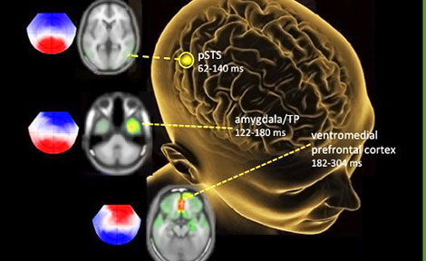 Forging a new field of social neuroscience | The University of Chicago